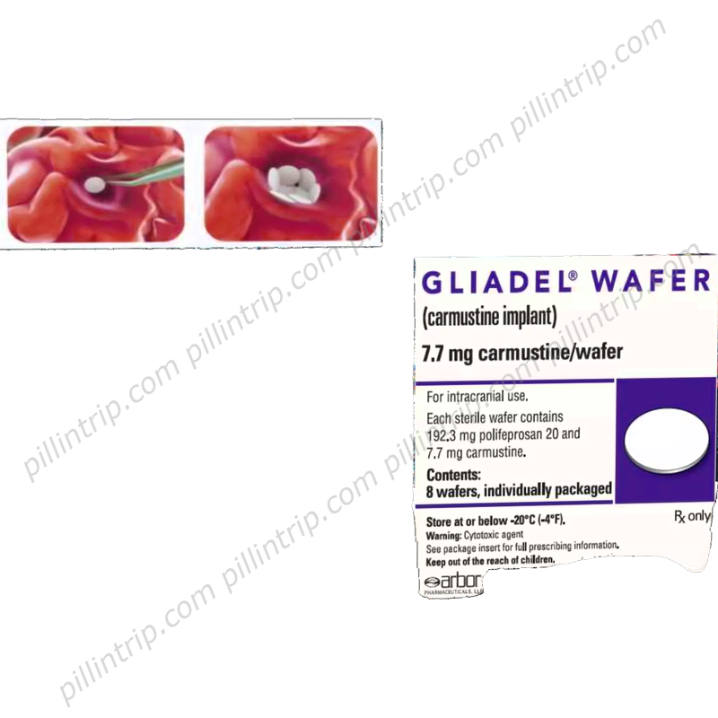Gliadel Wafer : Uses, Side Effects, Interactions, Dosage / Pillintrip